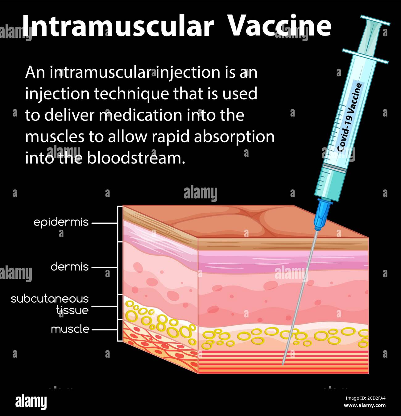 Information vector on intramuscular injection illustration Stock Vector ...