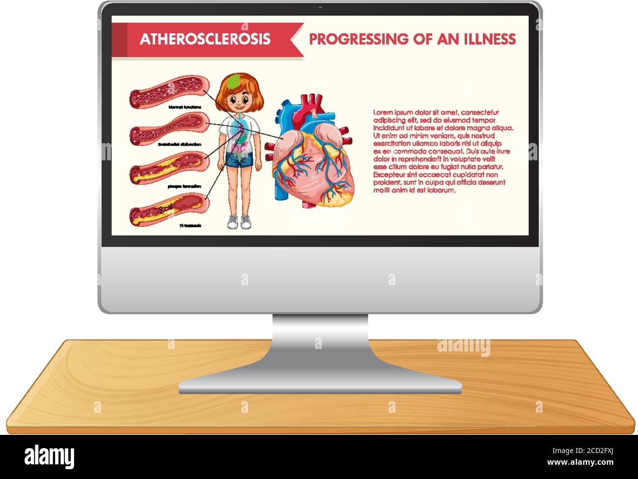 Computer with science infographic on screen desktop illustration Stock ...