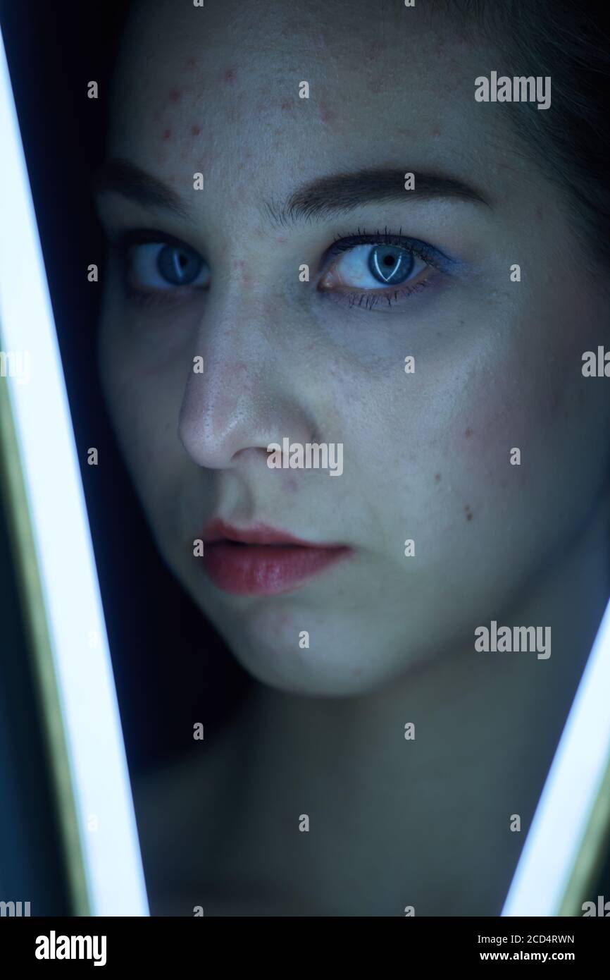 sad young woman with pimply skin in neon light looking at camera Stock ...