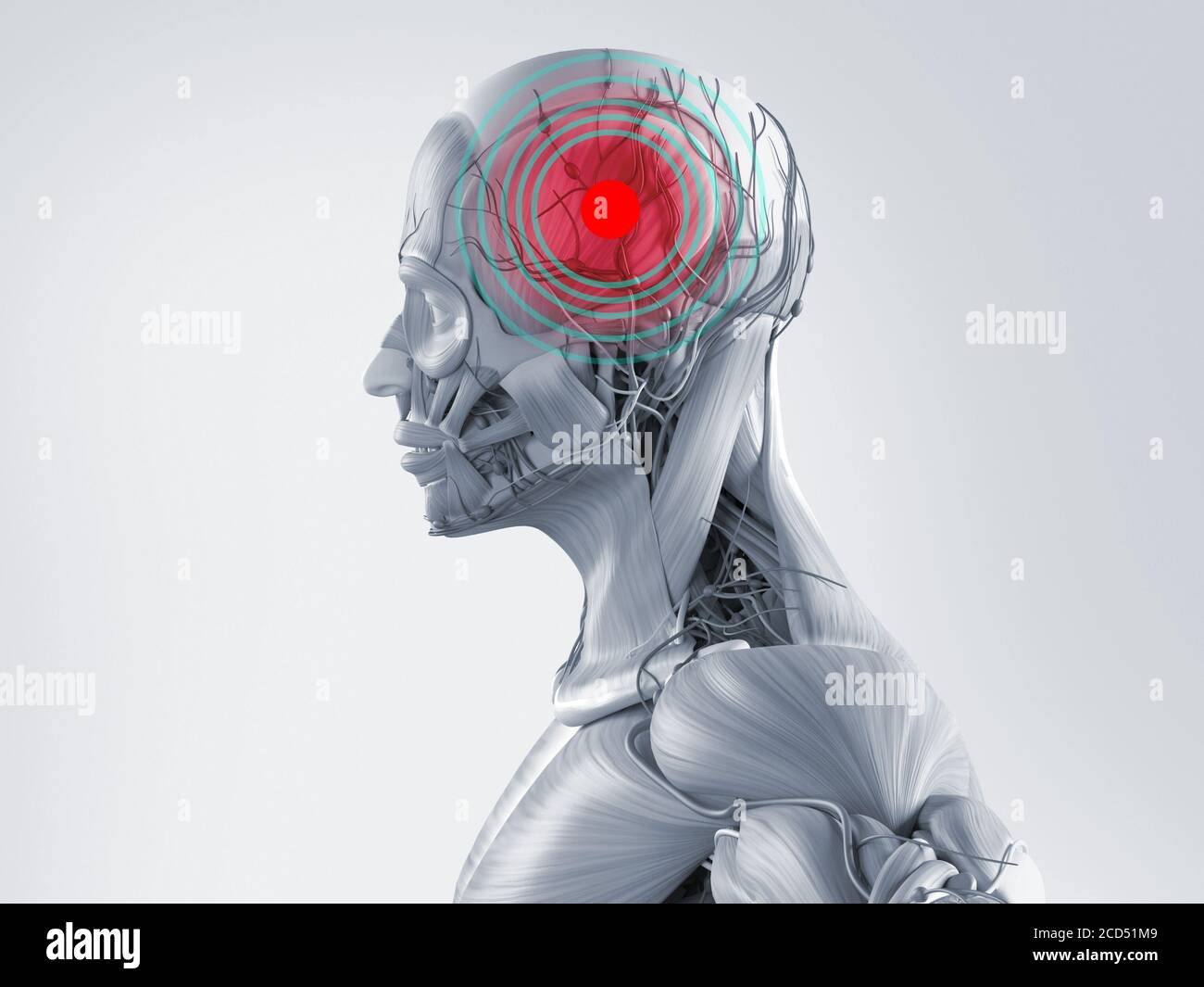 Woman face showing head pain hi-res stock photography and images - Alamy