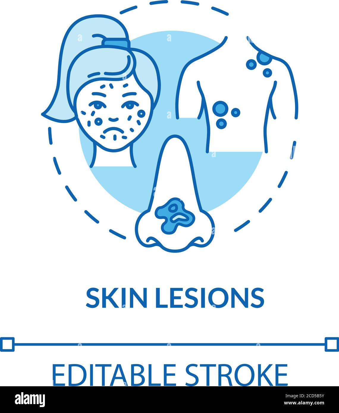 Skin lesions concept icon Stock Vector Image & Art - Alamy