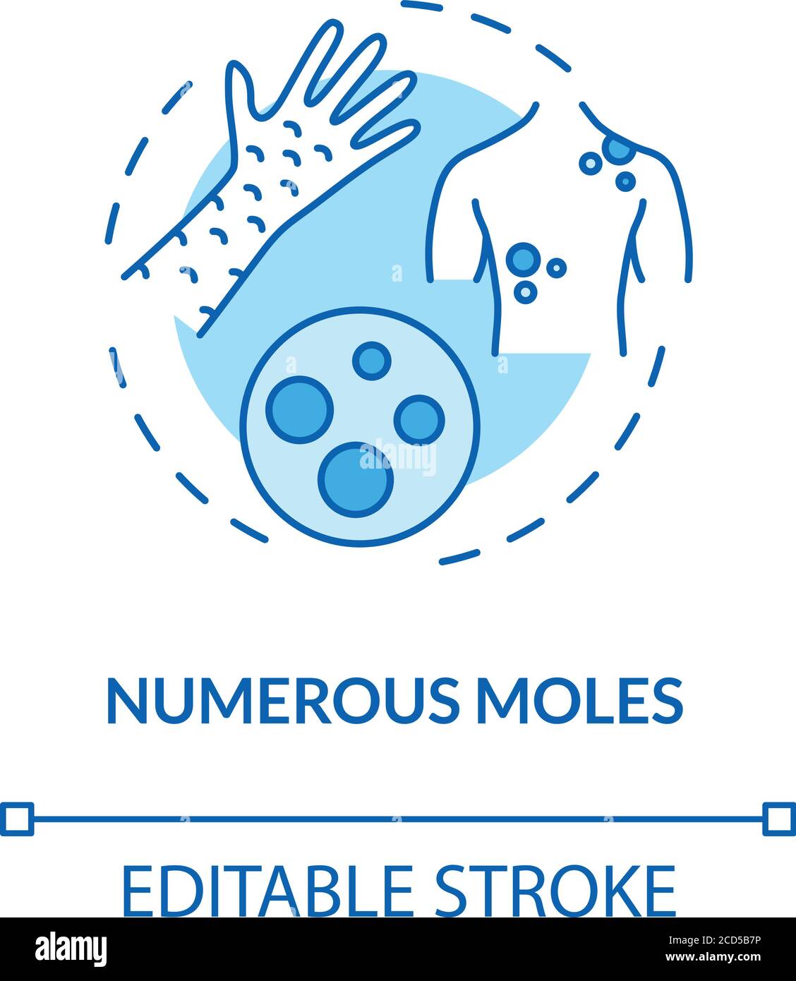 Moles and melanoma Stock Vector Images - Alamy