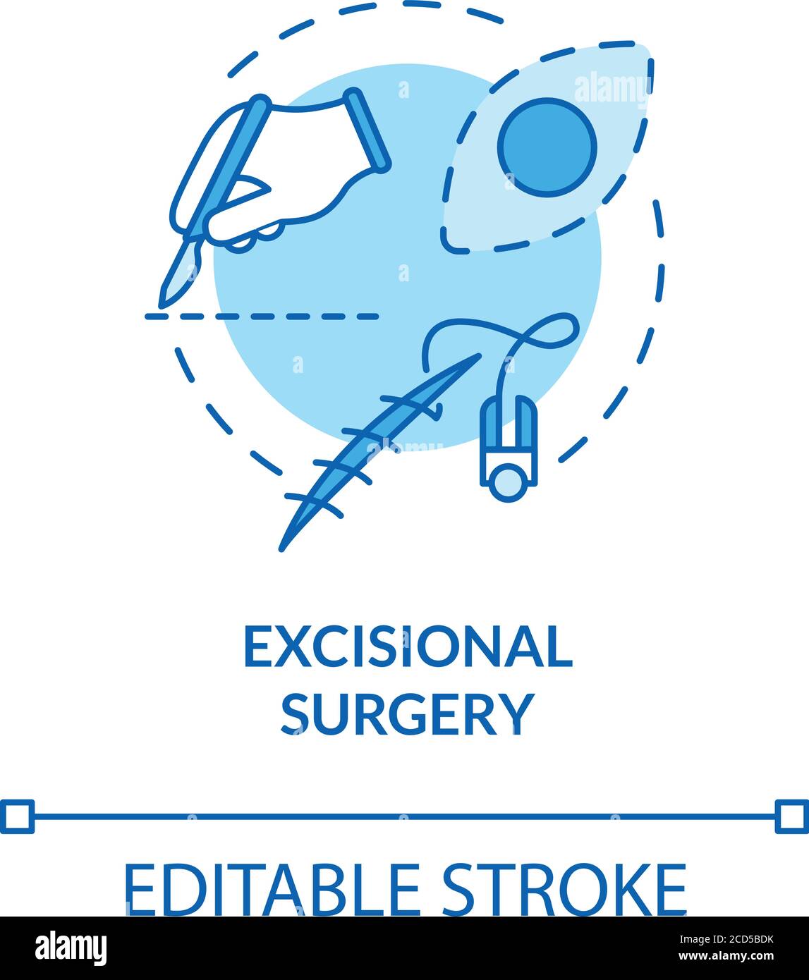 Surgical excision Stock Vector Images - Alamy