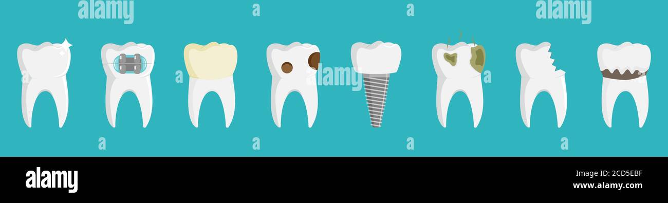 Set of teeth, healthy and witn different dental problems, stock vector ...