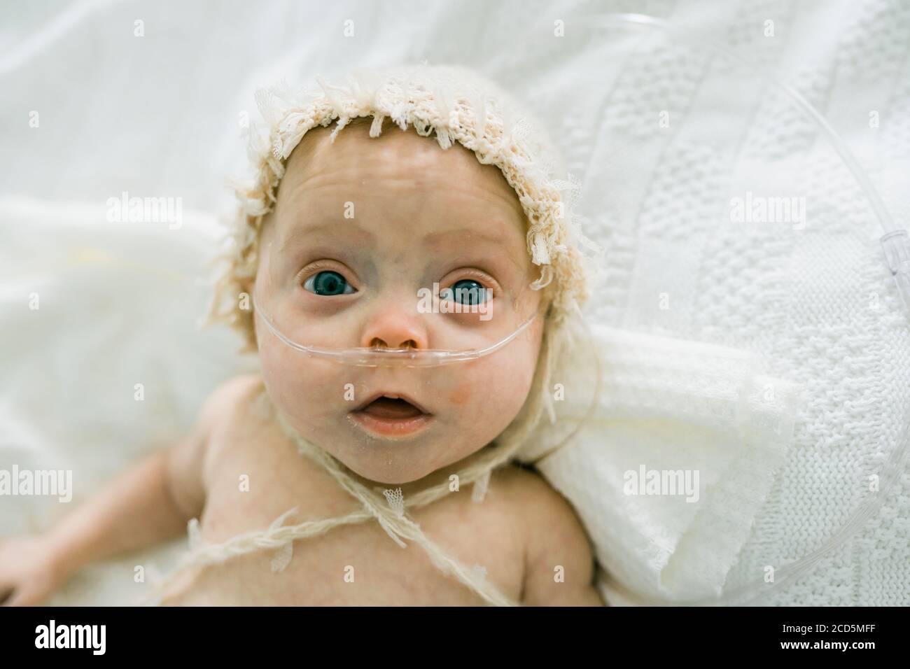 Baby breathing tube hi-res stock photography and images - Alamy