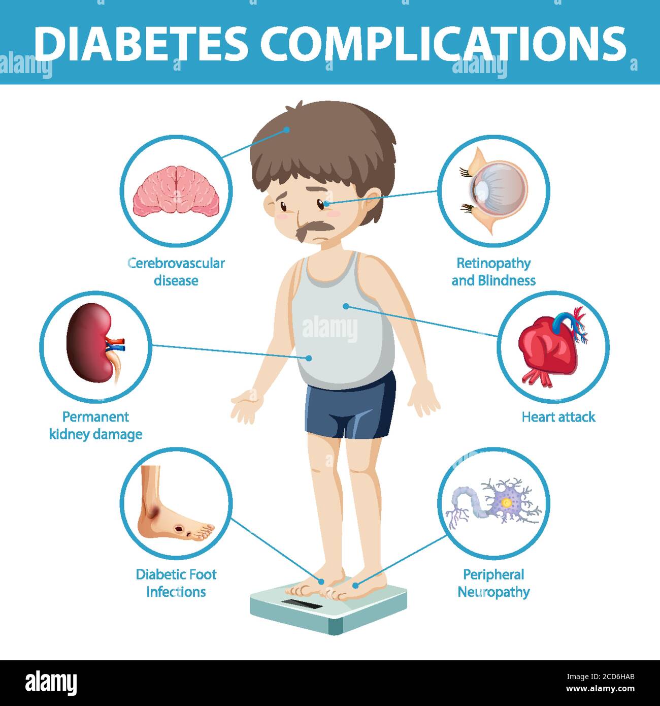 Diabetes complications information infographic illustration Stock ...