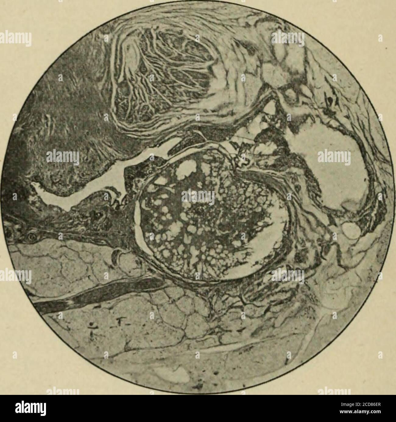 Conjunctival sac hi-res stock photography and images - Alamy