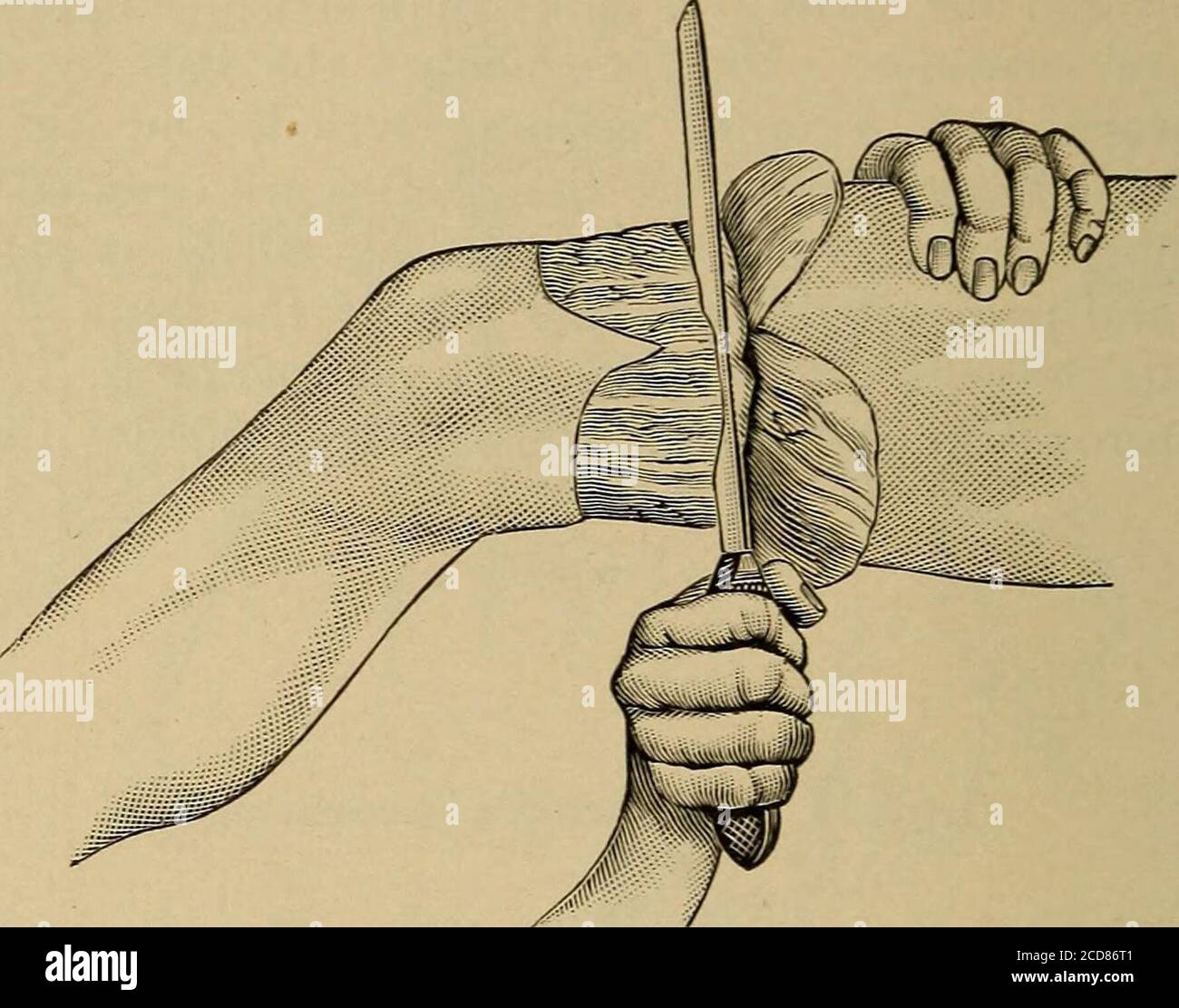 . Minor and operative surgery, including bandaging . Amputation by ...