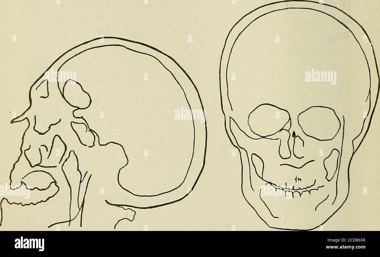 Plegia hi-res stock photography and images - Alamy