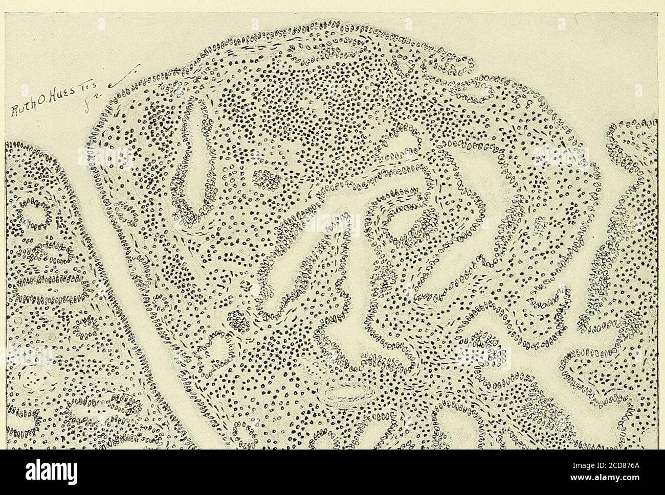 Luteal cells hi-res stock photography and images - Alamy