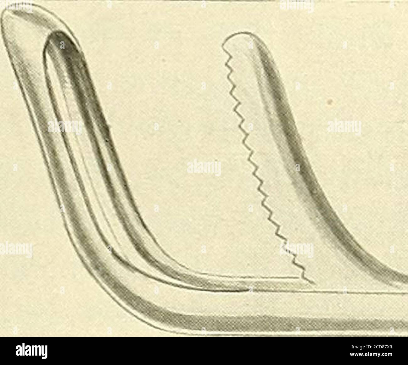 . Surgery, its principles and practice . Fig. 19L—Handle of Bigelows ...