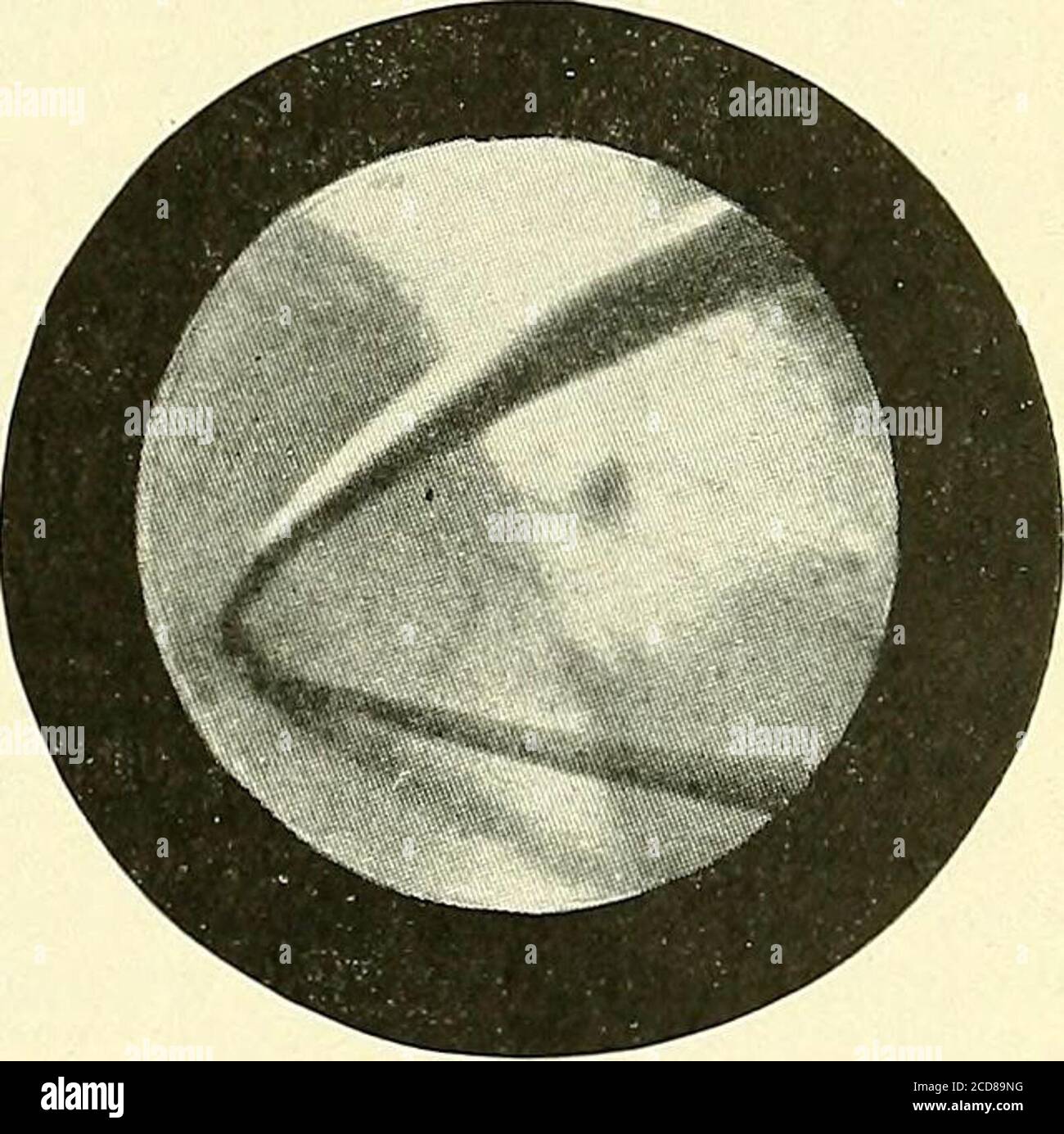 Suprapubic area hi-res stock photography and images - Alamy