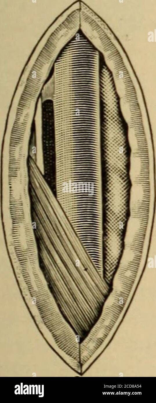 . Minor and operative surgery, including bandaging . Lines of incision ...