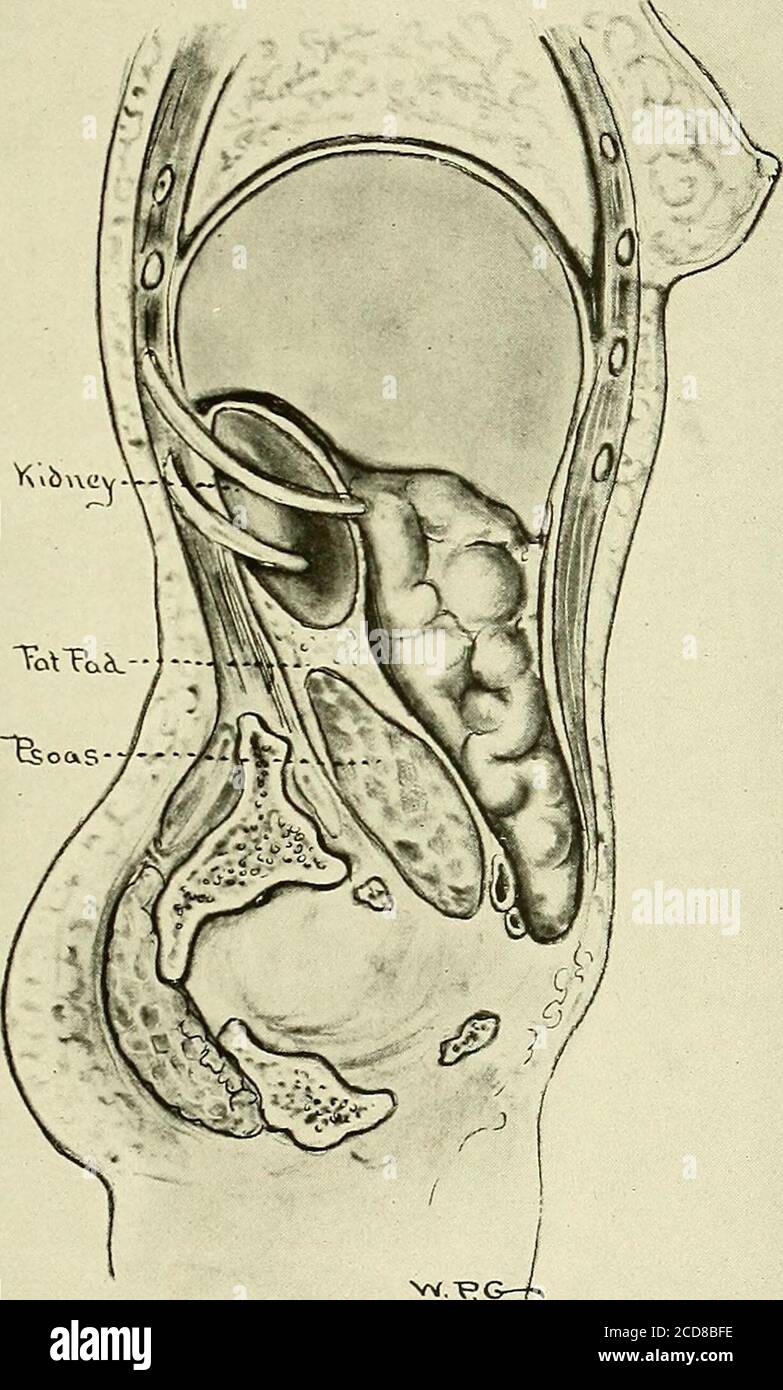 . Gynecology : . rather meager suspensoryligaments. If, therefore ...