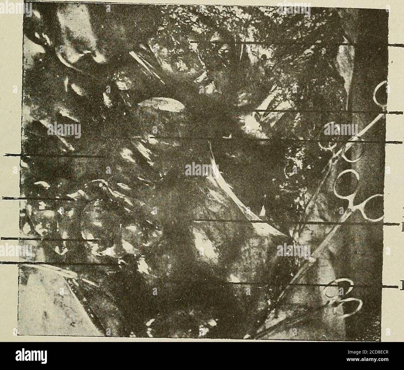 . Medical and surgical therapy . -Ar. Fig. D.—a. r. Renal artery.*- F ...