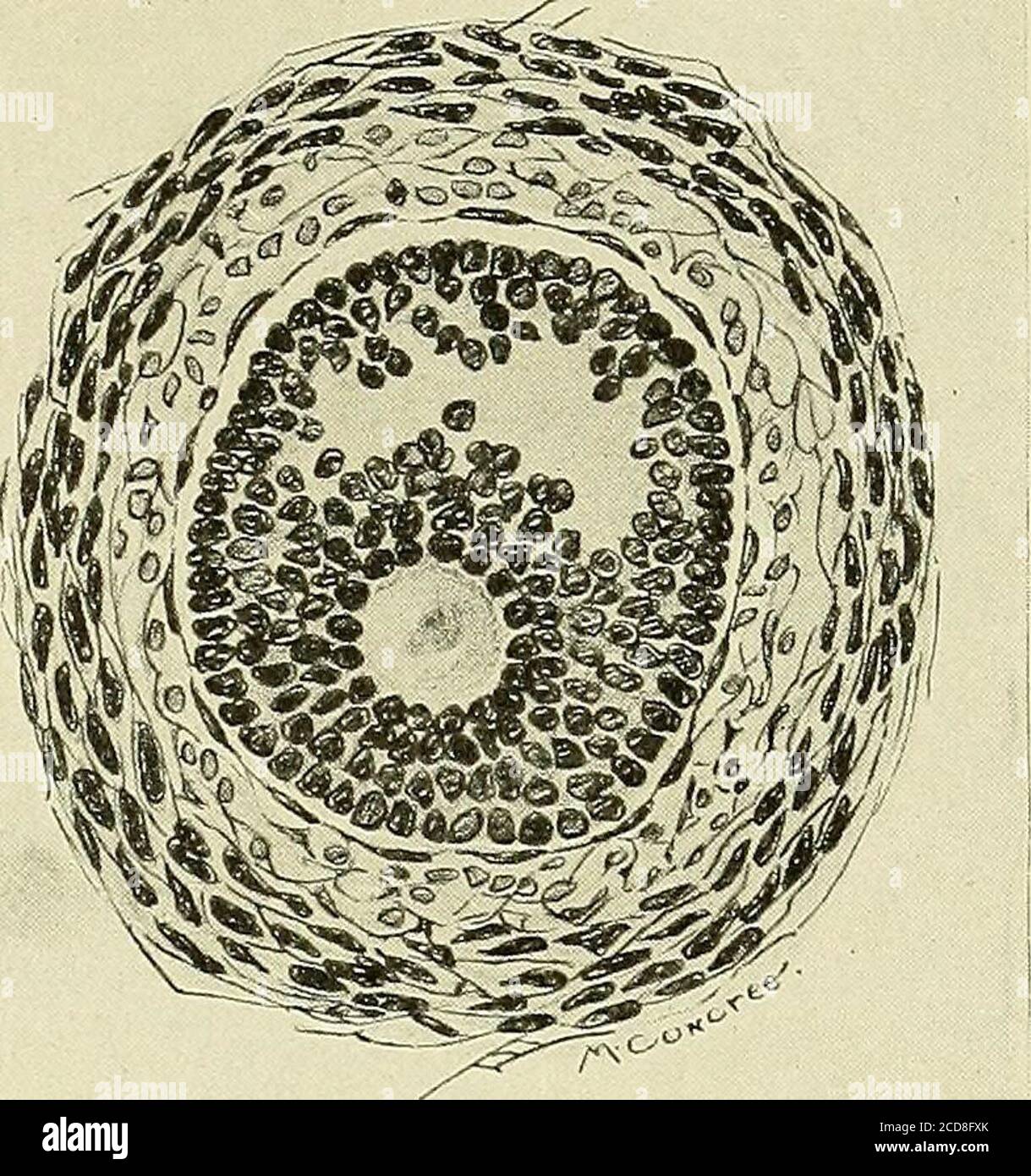 . Gynecology : . Fig. 11.—Earlt Development of the Follicle.On the left ...