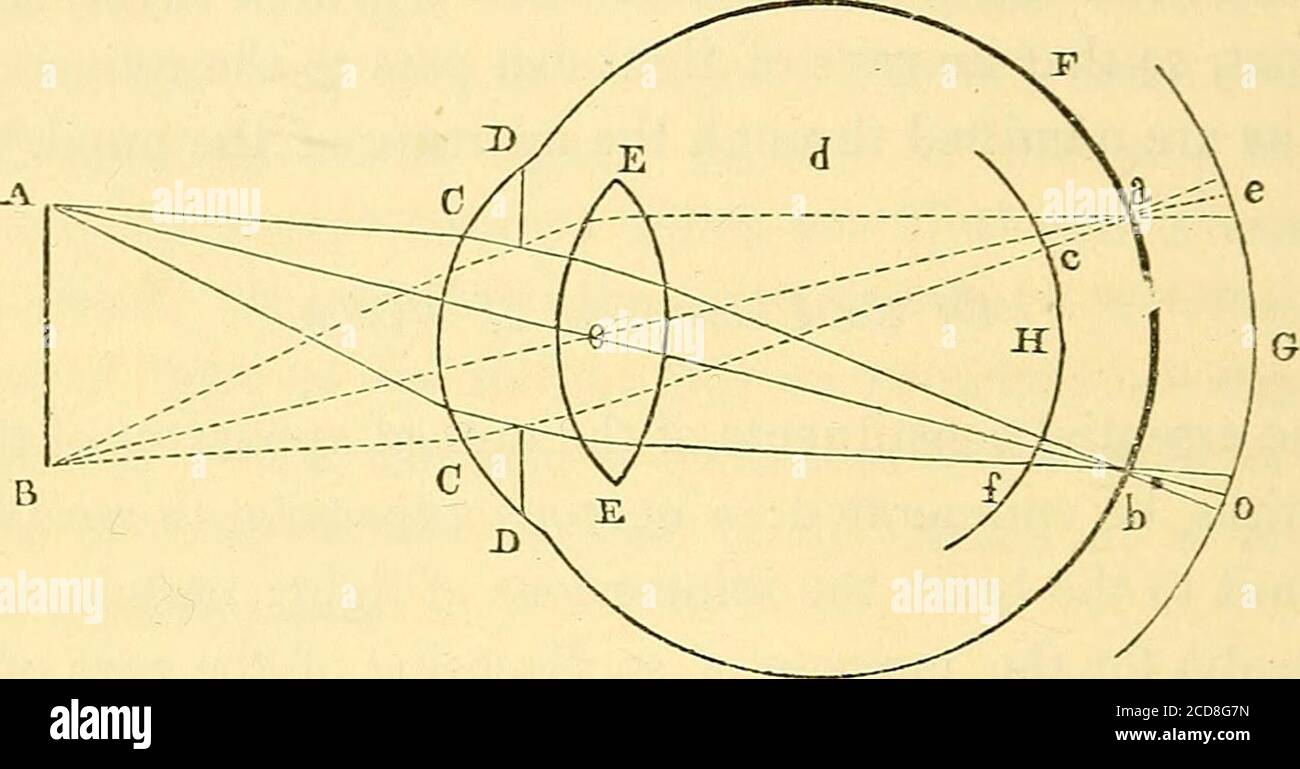 Anterior cones hi-res stock photography and images - Alamy