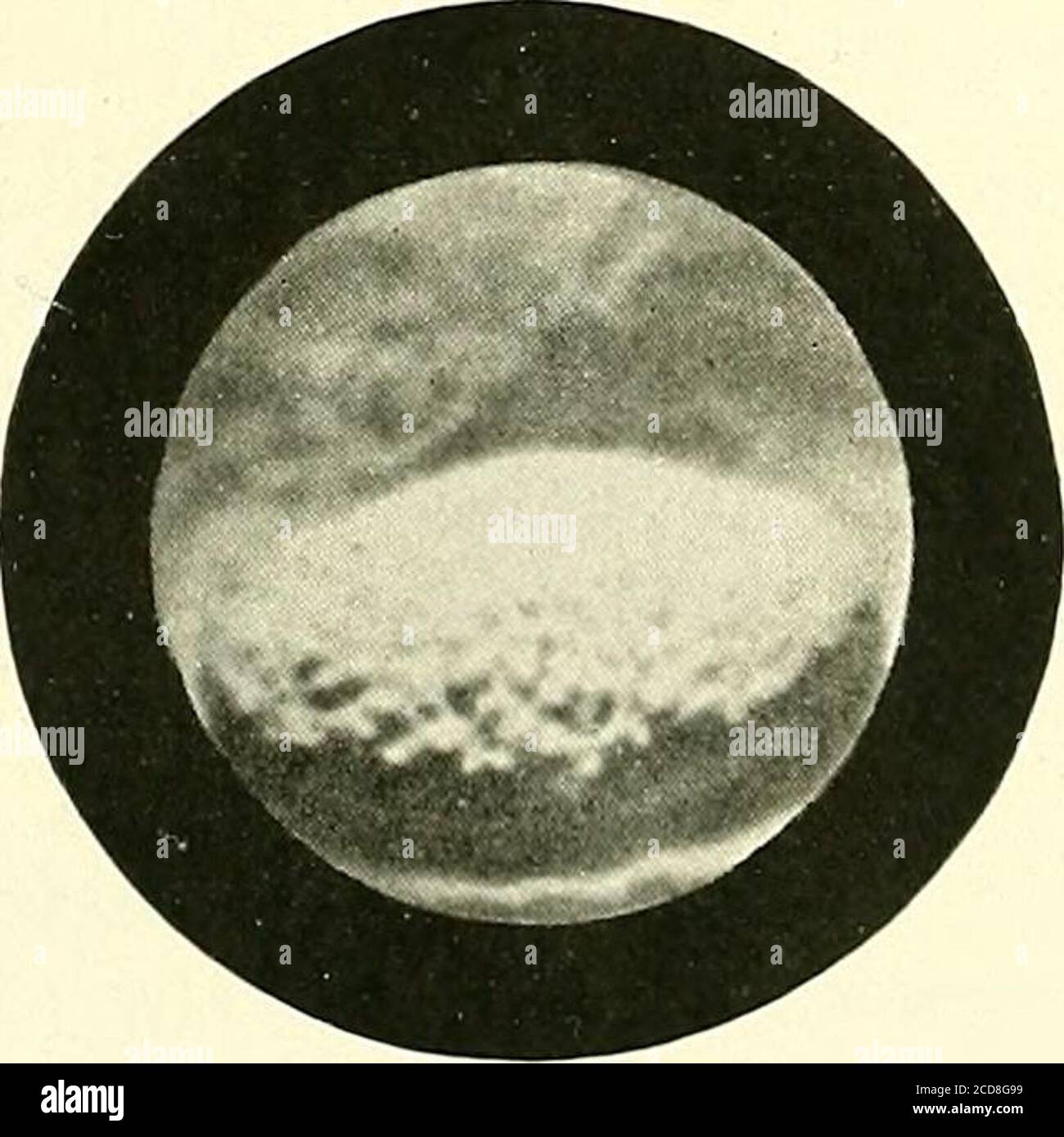 . Surgery, its principles and practice . Fig. 171.—Photographic ...