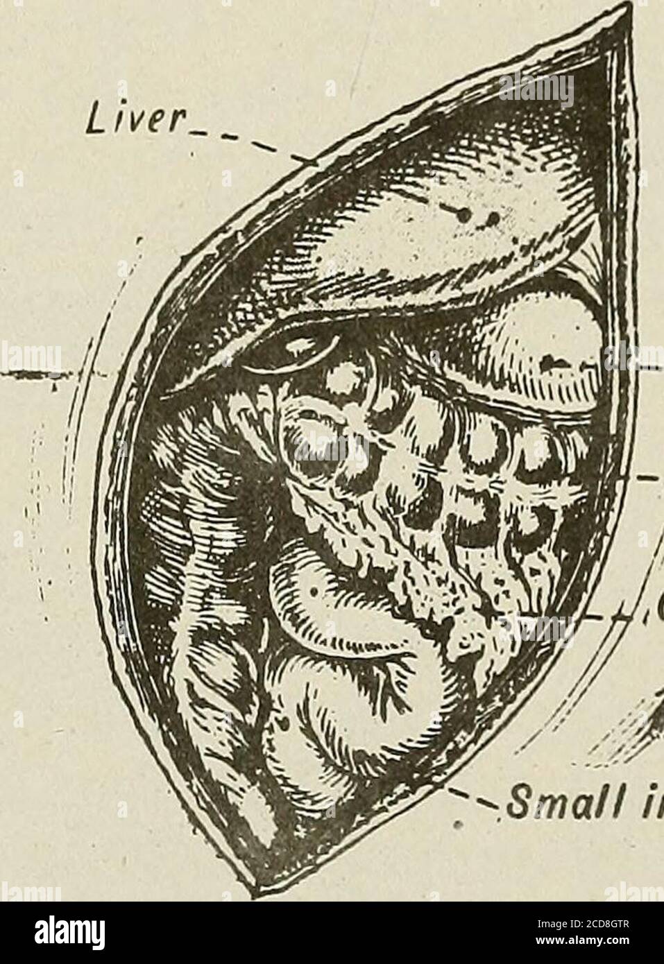 Splenic angle hi-res stock photography and images - Alamy