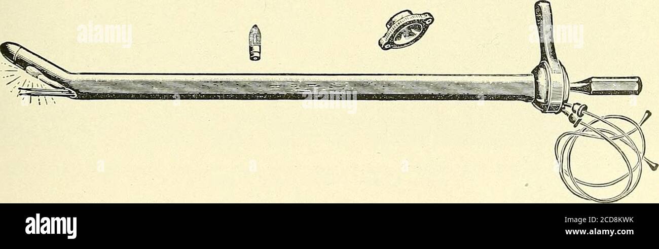. Surgery, its principles and practice . Fig. 159.—Indirect ...