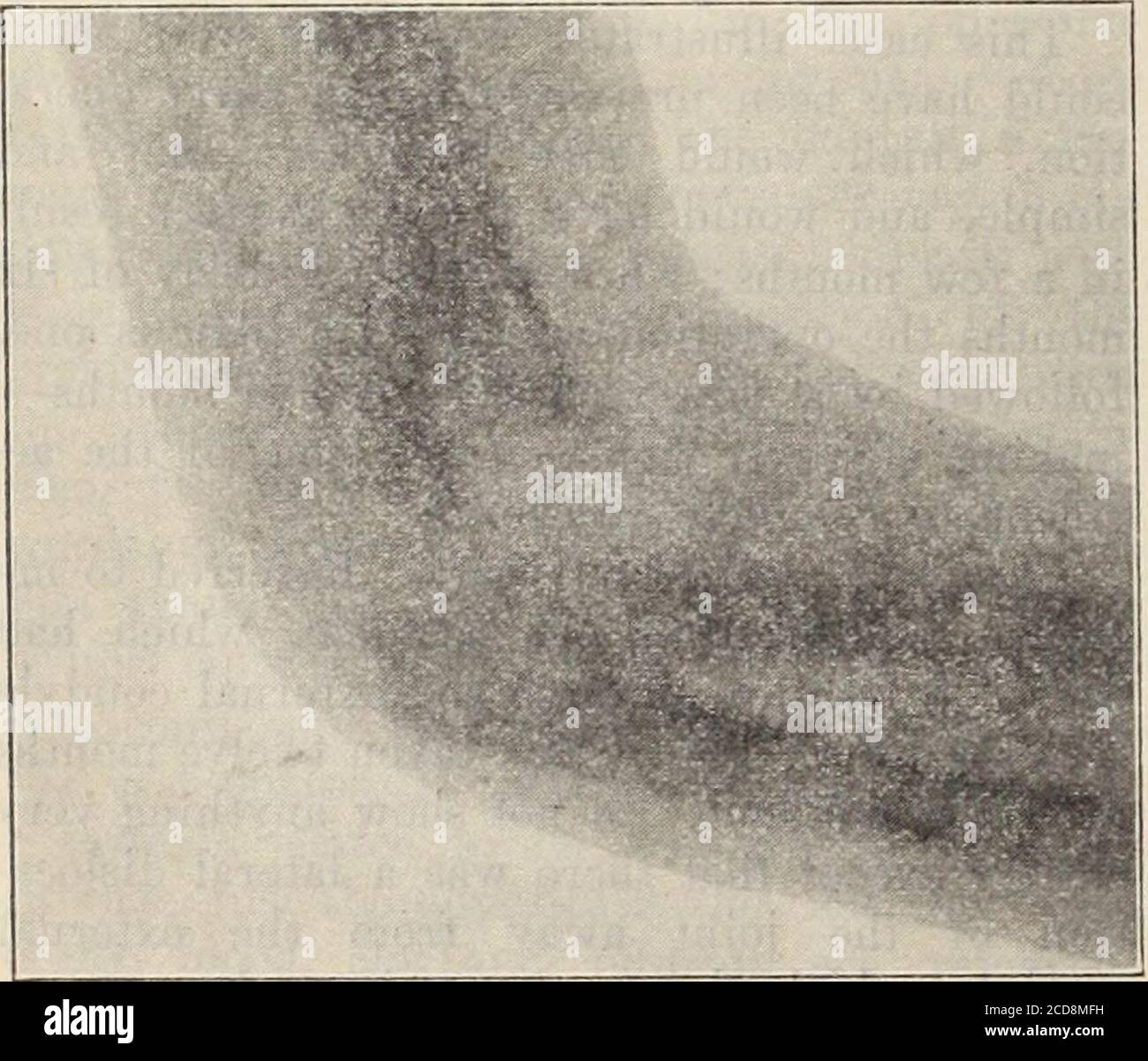 Chloroform anesthesia hi-res stock photography and images - Alamy