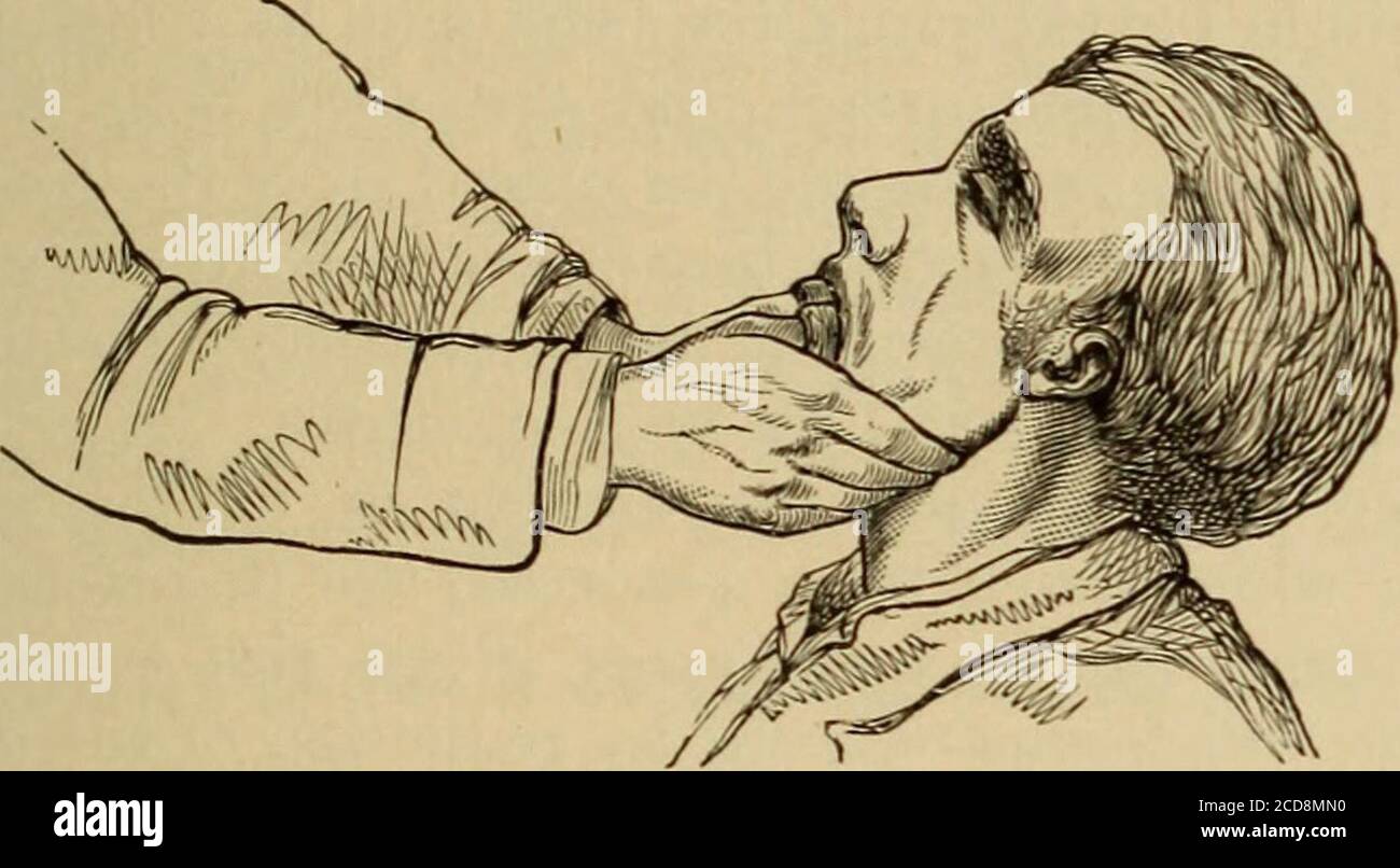 . Minor and operative surgery, including bandaging . Bilateral ...