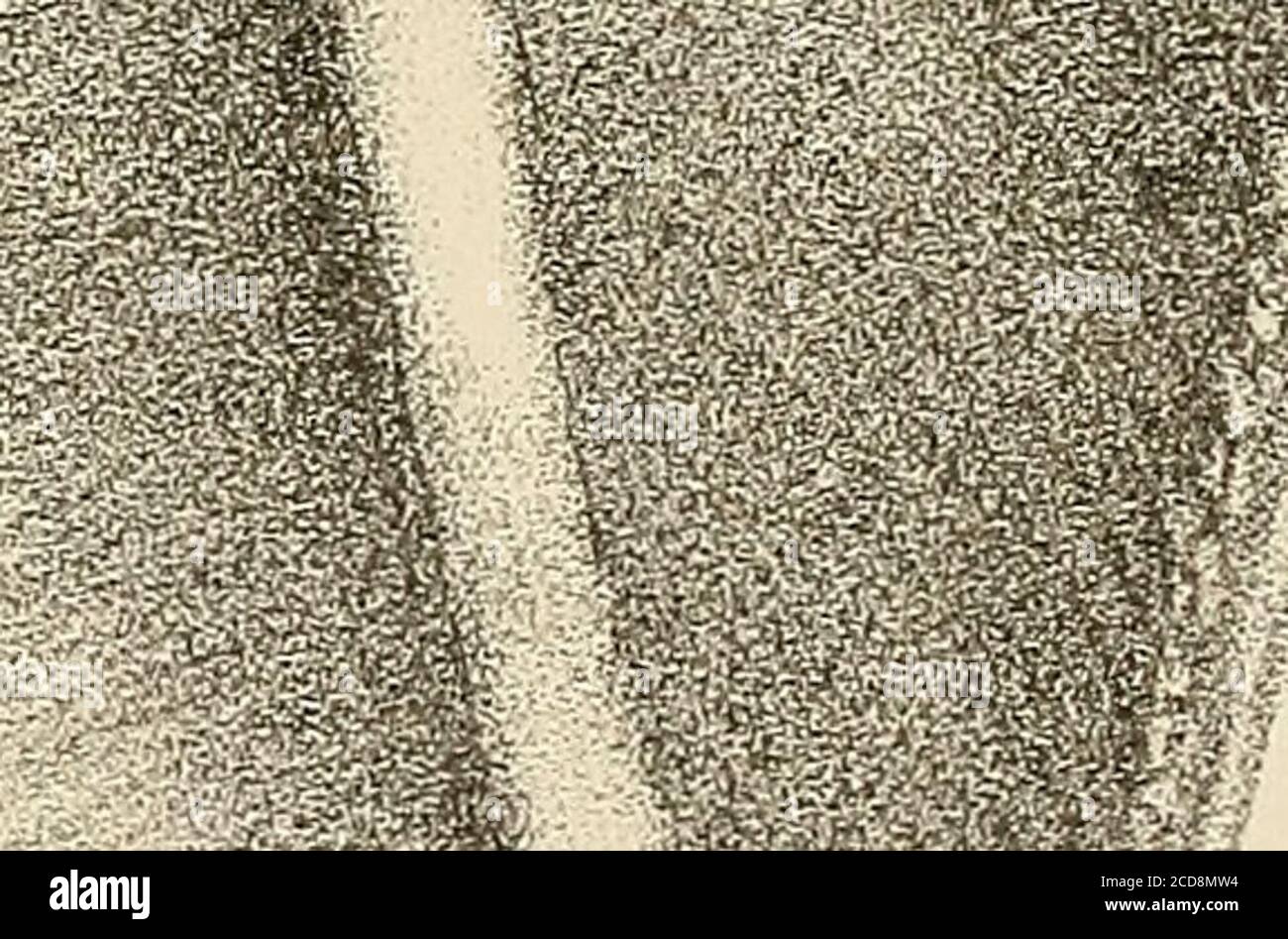 . Anatomy of the parts concerned in femoral rupture . lFossa (op, cit ...