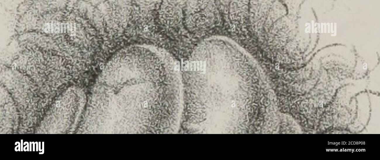 . Plates illustrating a treatise on the malformations, injuries, and ...