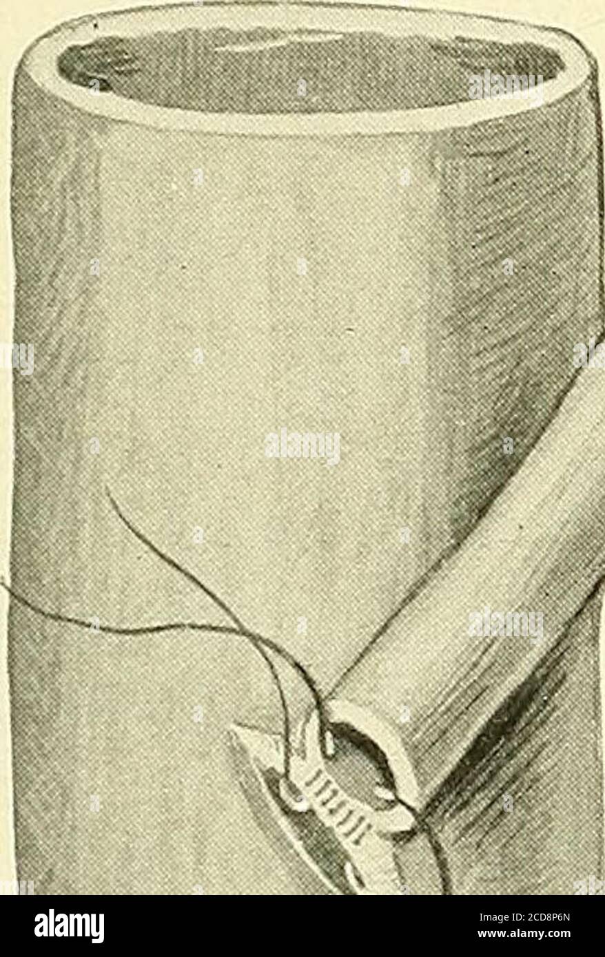 . Surgery, its principles and practice . ntroduced to facilitate the ...