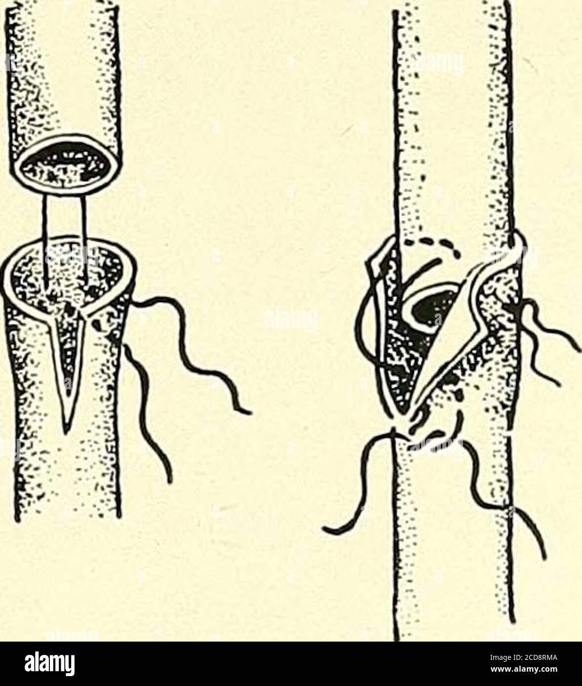 . Surgery, its principles and practice . Fig. 136.—Ureteeo-anastomosis ...