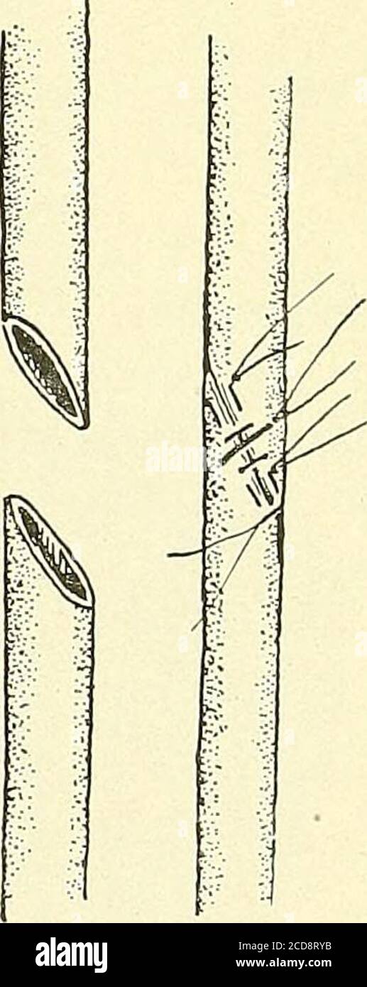 . Surgery, its principles and practice . uberculosisor pyonephrosis ...