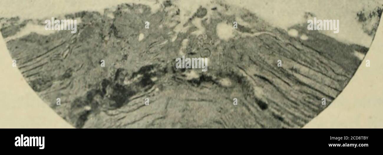 Retinal pigment epithelium hi-res stock photography and images - Alamy