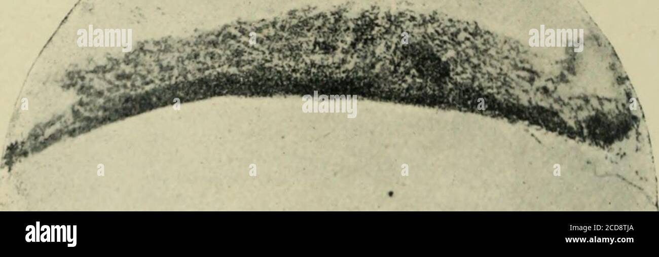 . Transactions . Periphery of cornea, showing termination of epithelium ...