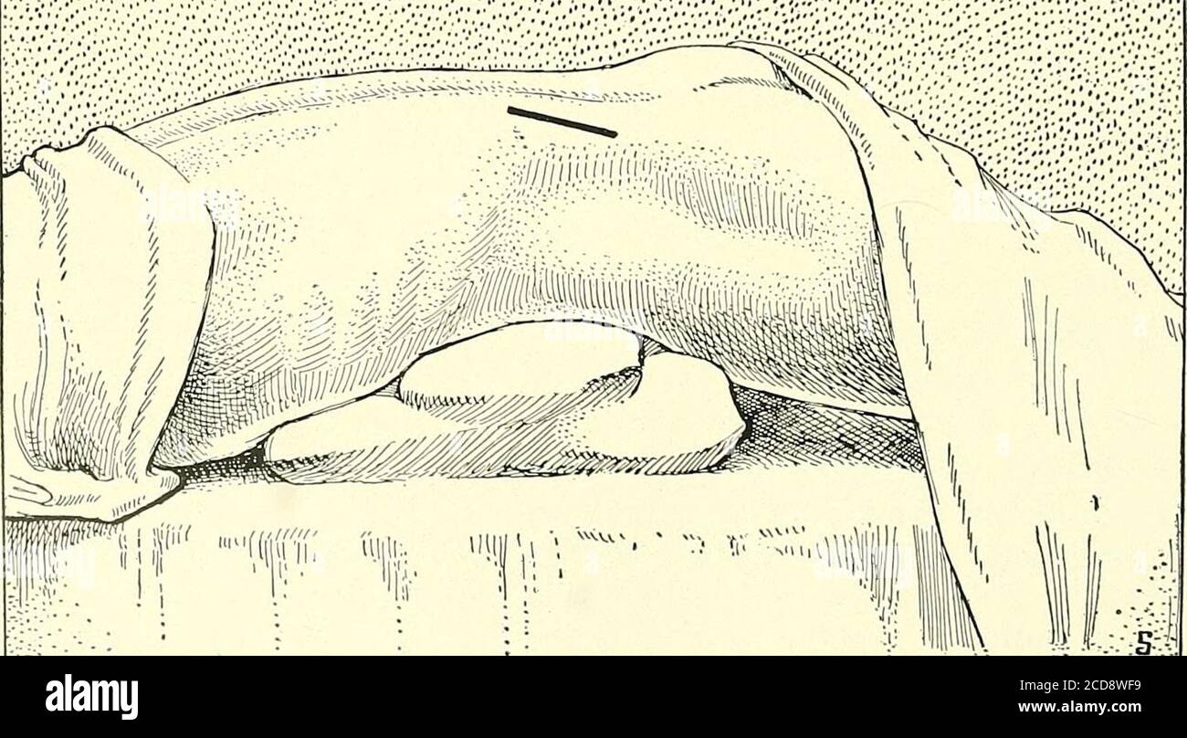 Lumbar incision hi-res stock photography and images - Alamy