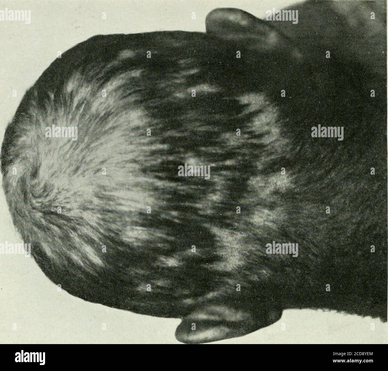 Kerion hi-res stock photography and images - Alamy