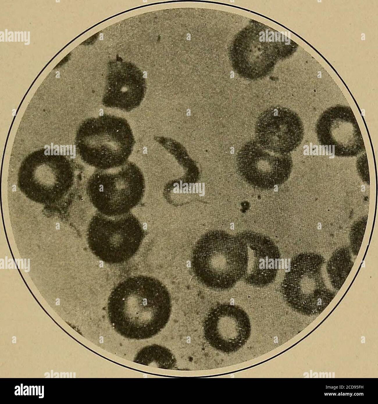 Wassermann test hi-res stock photography and images - Alamy