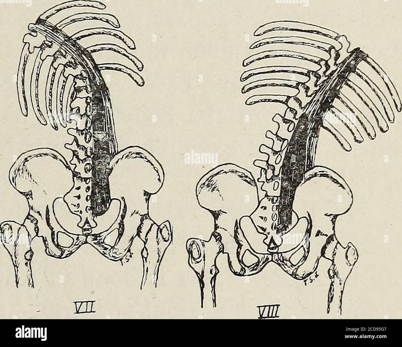 . The Cleveland medical journal . Ilio costa/is- Erecib/-S/>//f4e*. on ...