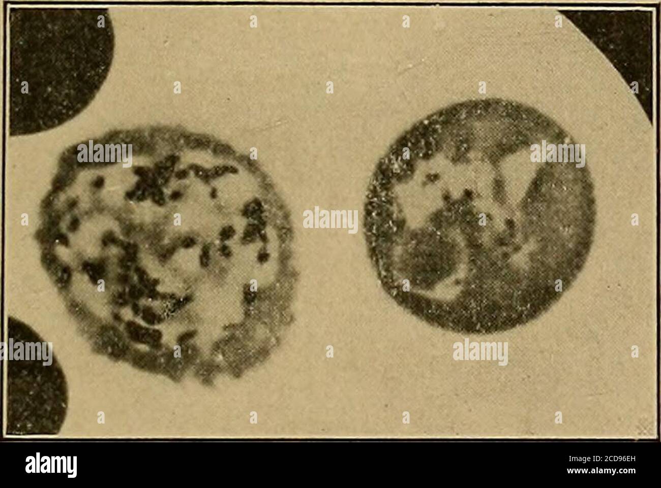 . Physical diagnosis . Fig. i.—Young Tertian Parasites. (Stained with ...