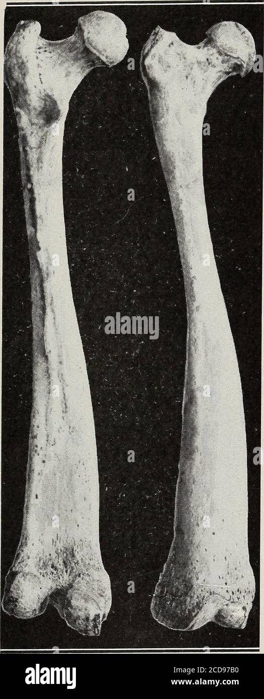 Transverse creases hi-res stock photography and images - Alamy