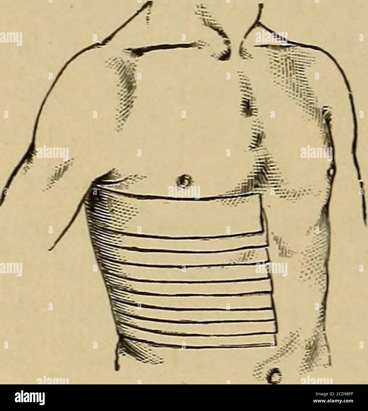 Muslin Binder Bandage