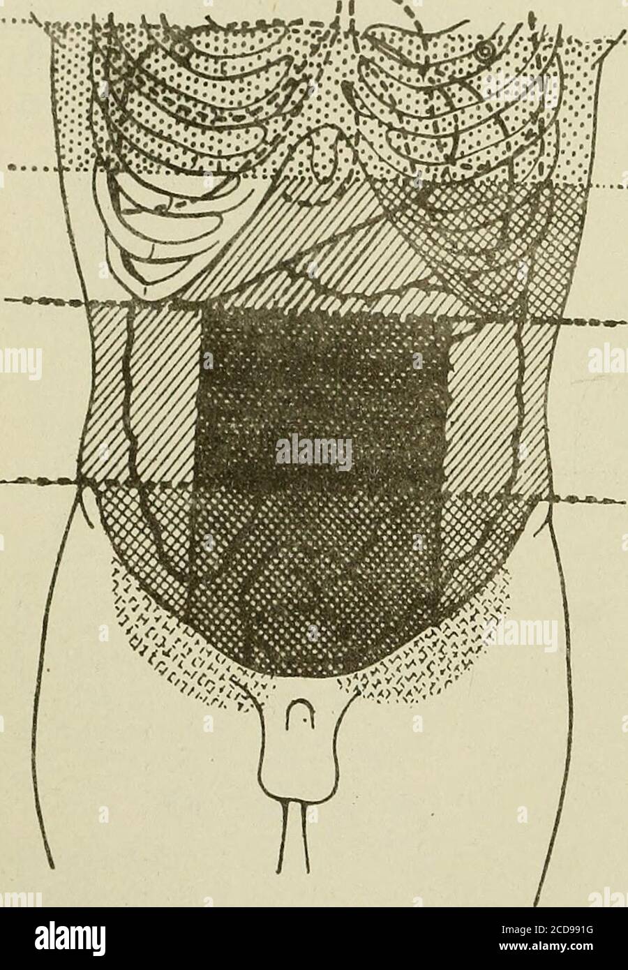. Medical and surgical therapy . colon Omentum FiG. 22.—Diaphragmatic ...