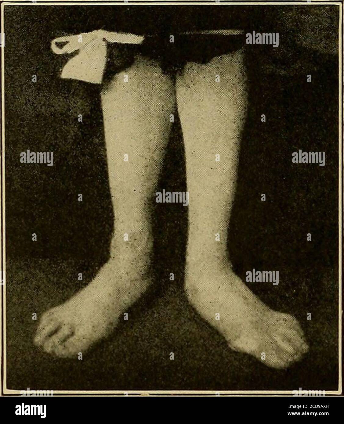 Associated leg bones hi-res stock photography and images - Alamy