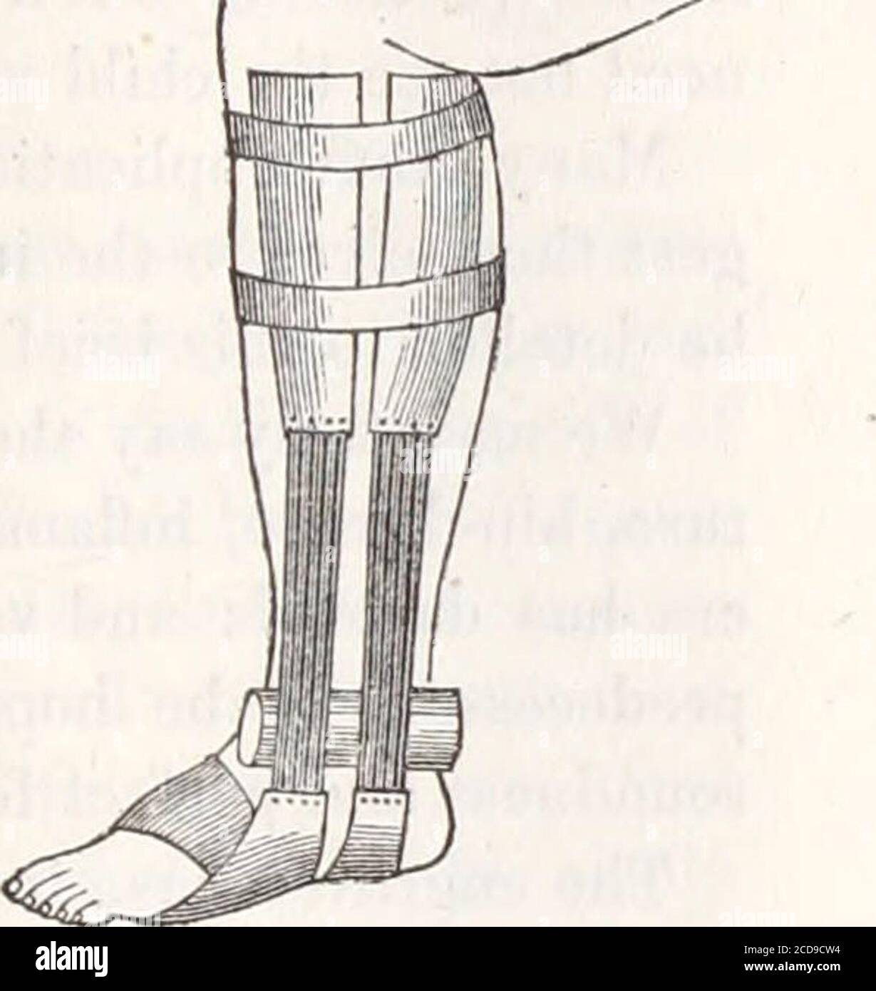 Attaching webbing hi-res stock photography and images - Alamy