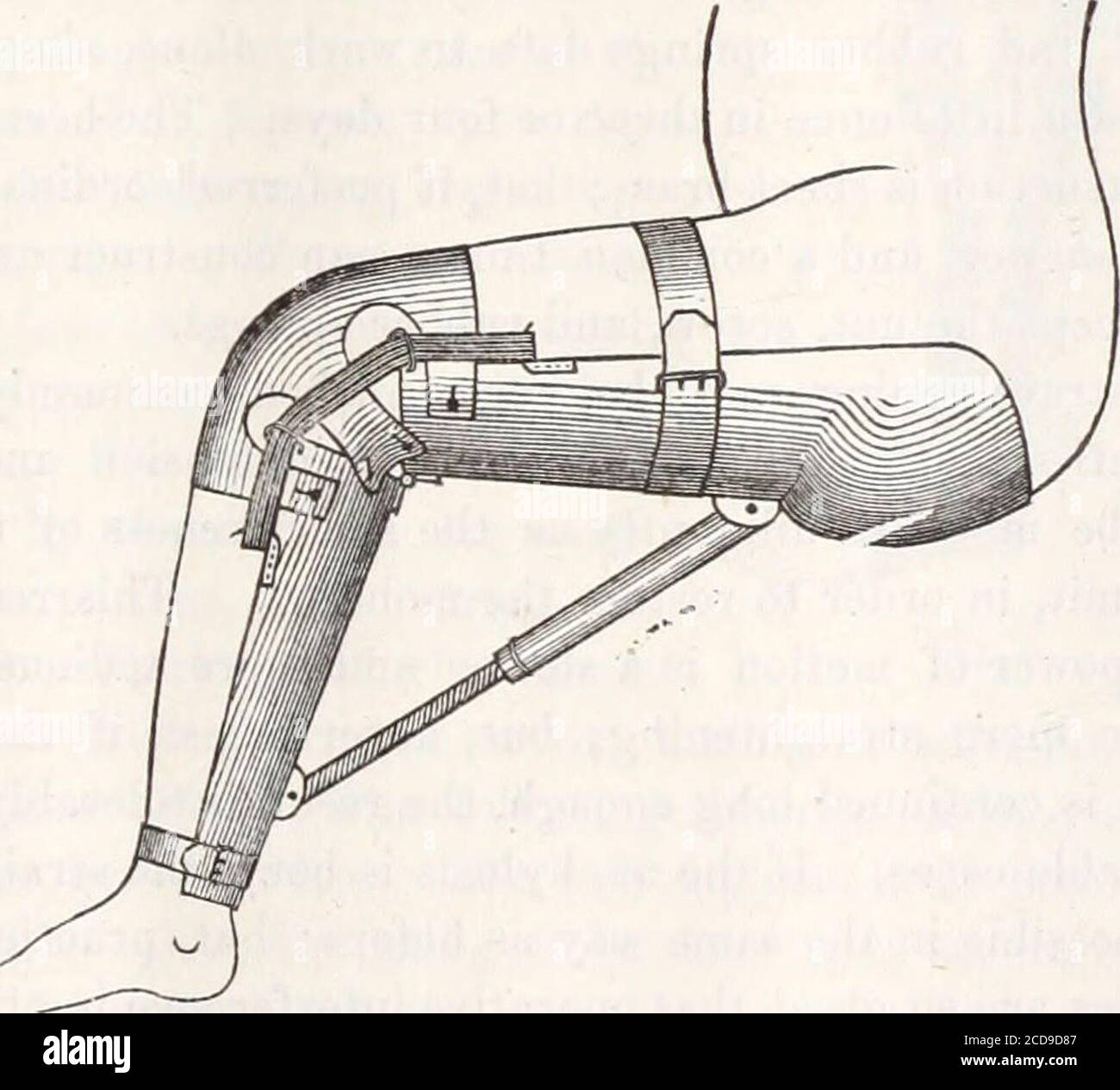 . Chicago medical examiner . tacles will yield to steady tension; and ...