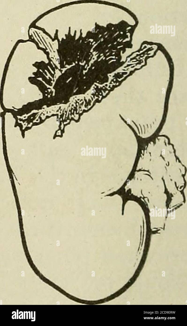 . Medical and surgical therapy . -^-^W?/^UV^^^^^^ pjr;. 13.—Punctiform ...
