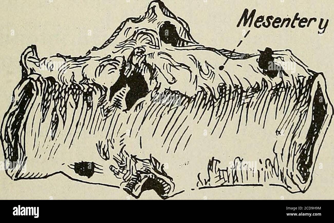 . Medical and surgical therapy . Mesentery. Fig. 10.—Specimens from a ...