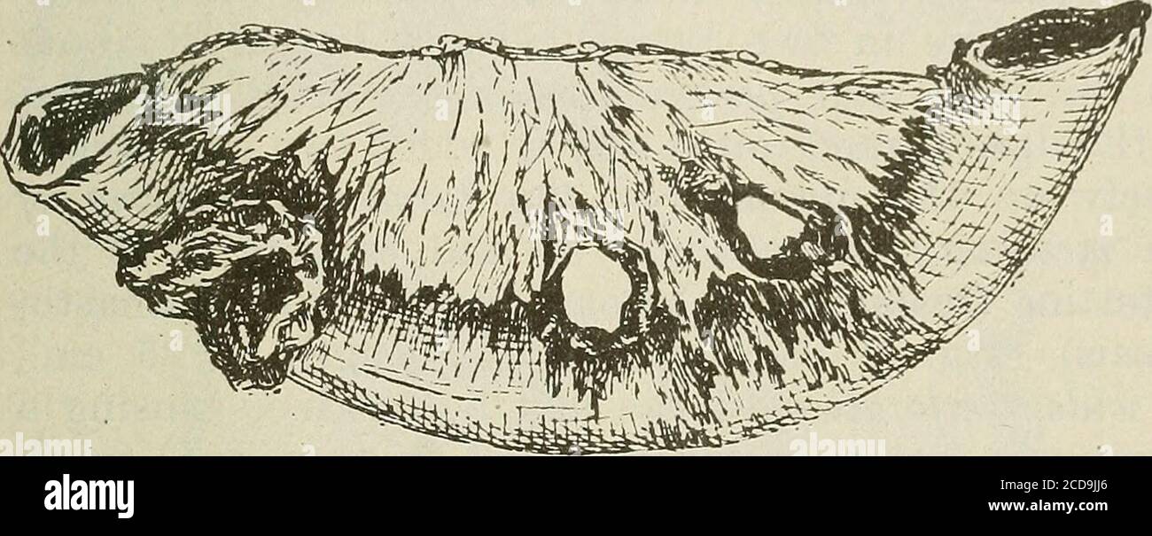 . Medical and surgical therapy . ^ fragments of ANATOMICAL LESIONS ...