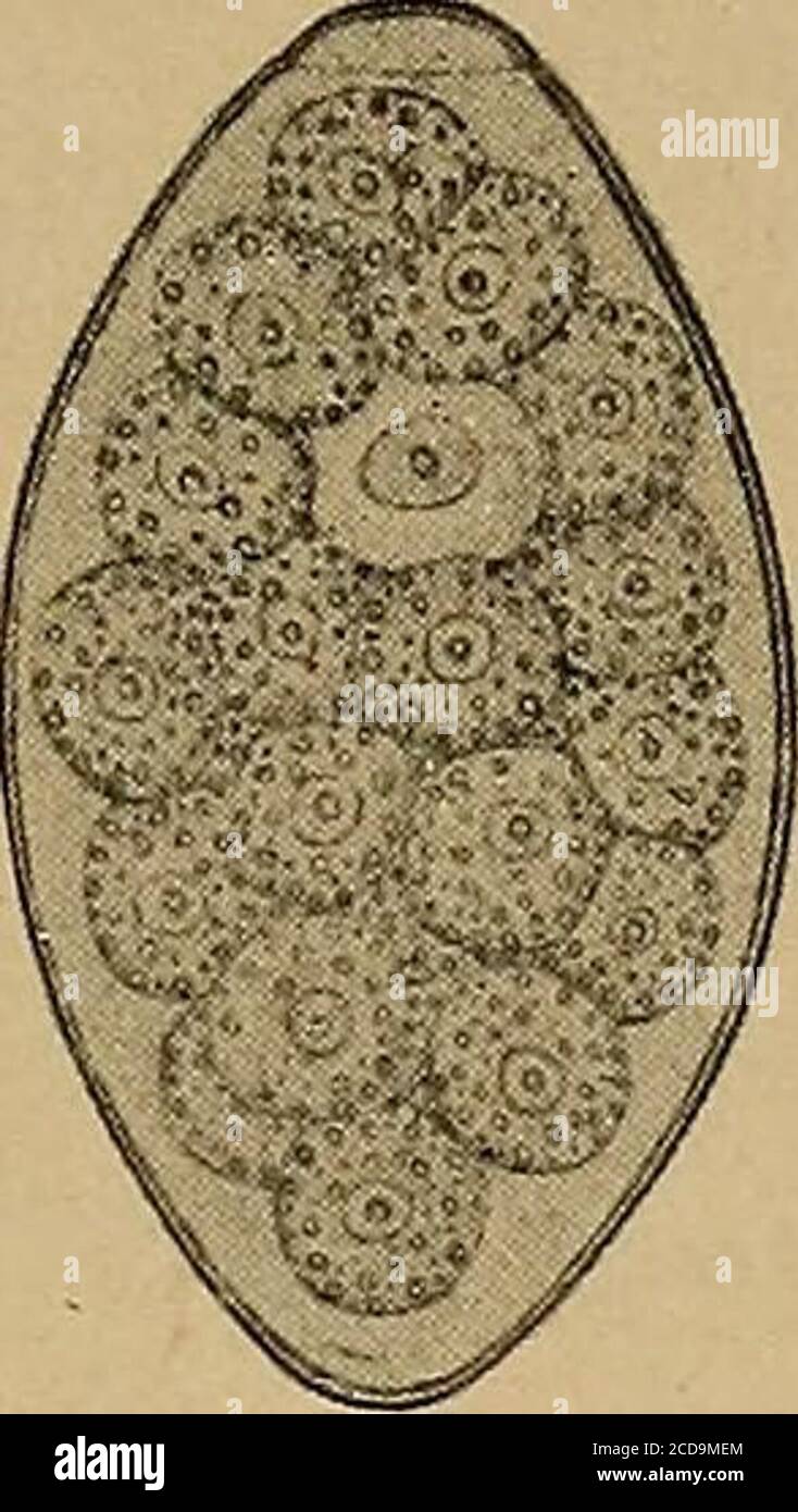 . Physical diagnosis . Fasciola hepatica.. Distoma buski ...