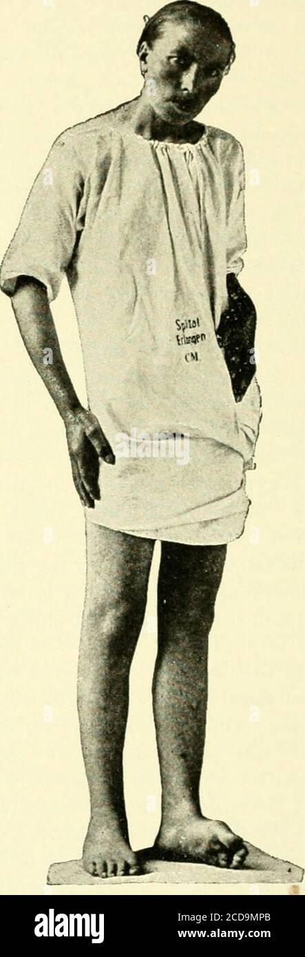 . A text-book of medicine for students and practitioners . Fig. 219 ...