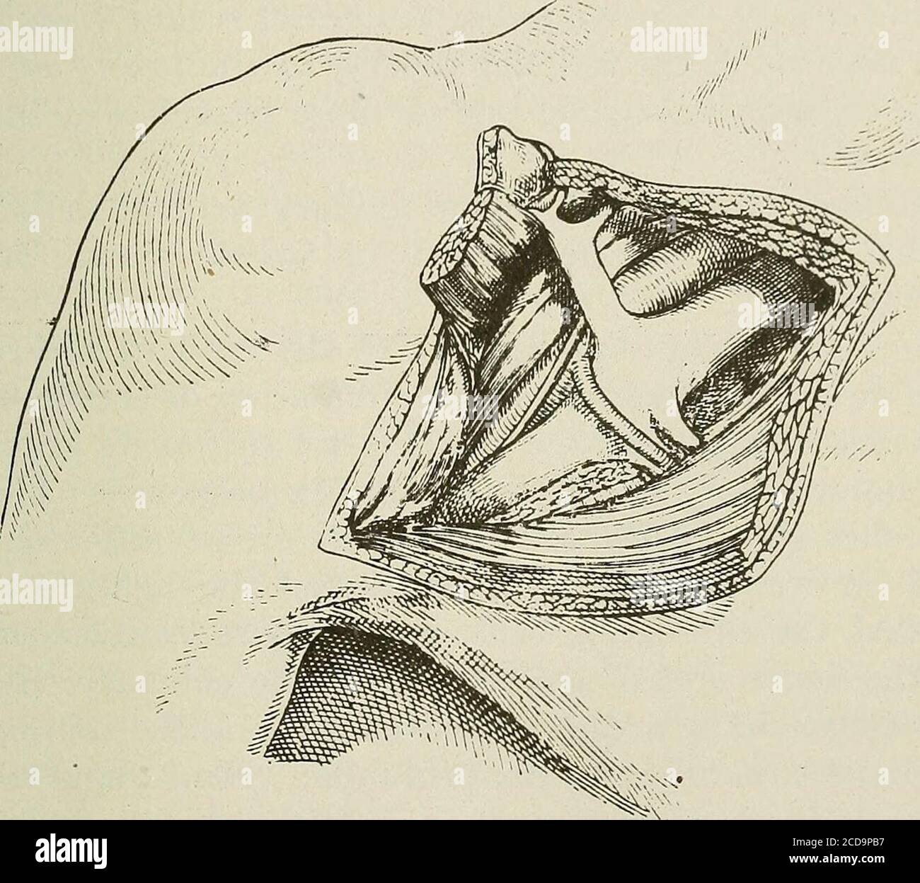 . Medical and surgical therapy . n )0^-^^^--^^^^^ Fi(!. nii.—Skin ...